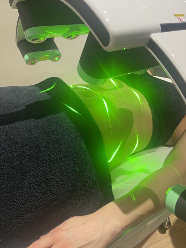 Emerald Laser Fat Removal | Emerald Laser | Light Touch Clinic