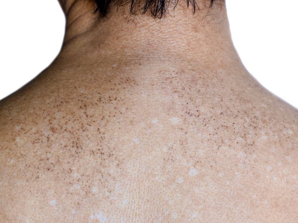 Award Winning Skin Clinic Surrey | Light Touch Clinic